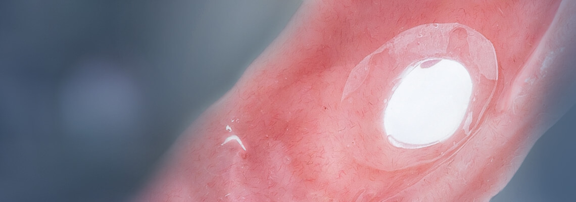 Institut für Anaplastologie - Epithetik und Spezialprothetik